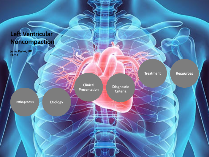 Left Ventricular Noncompaction by Jenna Essink on Prezi