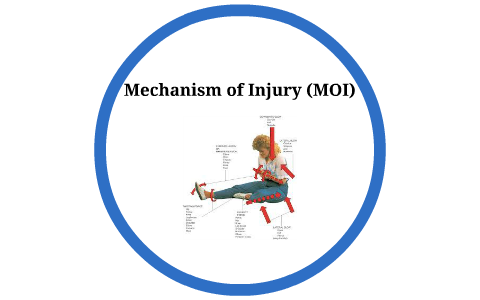 Mechanism of Injury (MOI) by Jack Leeber on Prezi