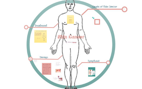 Disorders of the Integumentary System - Skin Cancer by Marissa Gossage ...