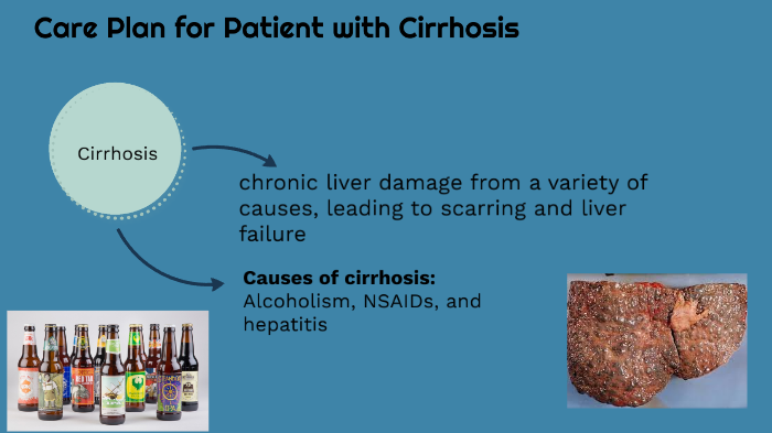 Nursing Care Plan for Patient with Cirrhosis by Macie King on Prezi