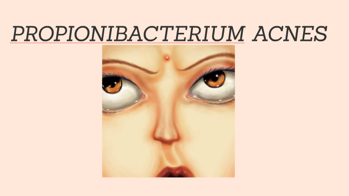 PROPIONIBACTERIUM ACNES by Zahra A. on Prezi