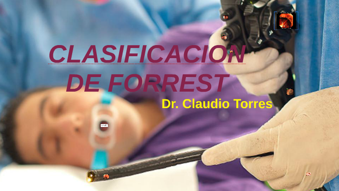 Clasificación Forrest by Claudio Torres on Prezi