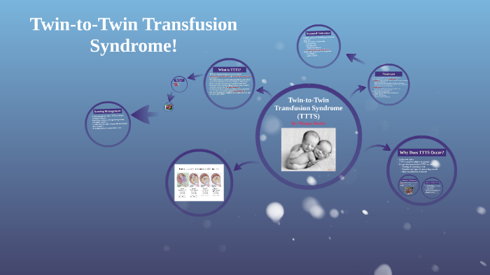 Twin-to-Twin Transfusion Syndrome (TTTS) by Meagan Dustin on Prezi