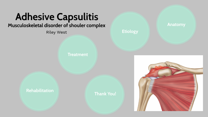 Adhesive Capsulitis by Riley west on Prezi