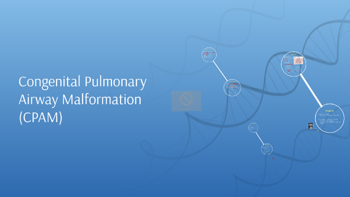 Congenital Cystic Adenomatoid Malformation by Preeti Panda on Prezi
