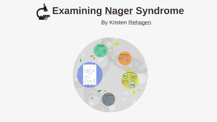 Examining Nager Syndrome by Kristen Rehagen on Prezi