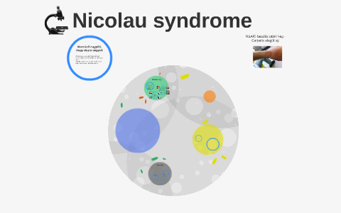 Nicolau syndrome by Andras Kirschner on Prezi