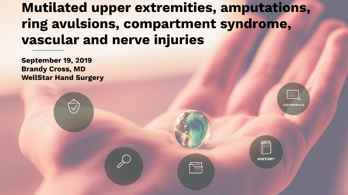 Mutilated upper extremities, amputations, ring avulsions, compartment ...