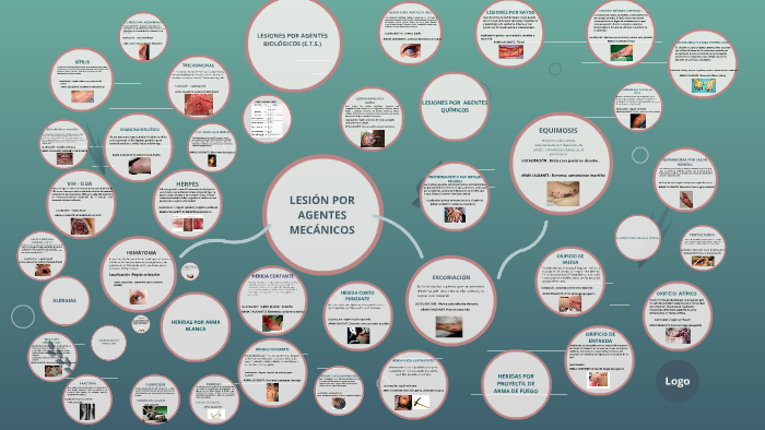 LESIÓN POR AGENTES MECANICOS by david garces useda on Prezi