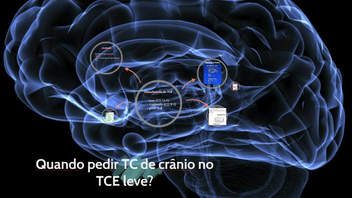 Quando pedir TC de crânio no TCE leve? by Victor Nóbrega on Prezi