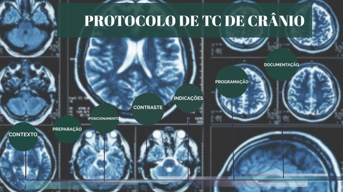 PROTOCOLO DE TC DE CRÂNIO by Julia Silveira on Prezi