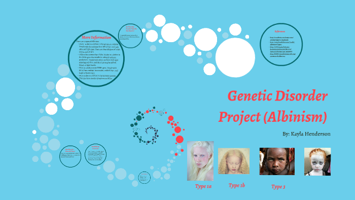 Genetic Disorder Project (Albinism) by Kayla Henderson on Prezi