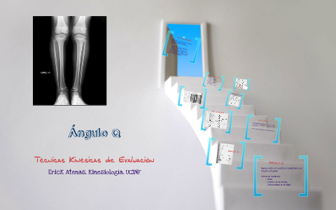 Ángulo Q by felipe felipe on Prezi