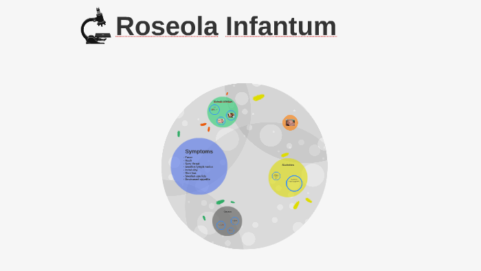 Roseola Infantum by Jahara Robles on Prezi