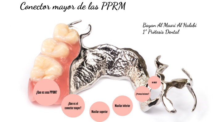 CONECTOR MAYOR PPRM by Bayan Al-Masri Al Halabi on Prezi