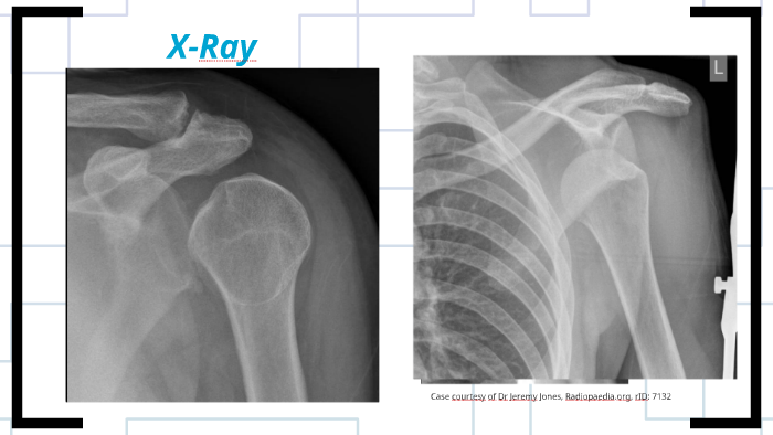 Reduction by Jon Osgood on Prezi