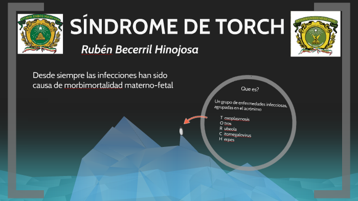 SINDROME DE TORCH by on Prezi