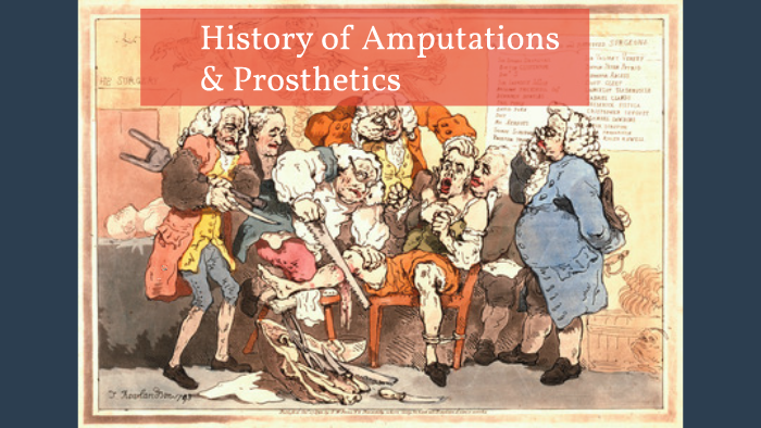 History of Amputations by Georgia Richens on Prezi