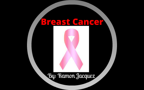 Breast Cancer by Ramon Jacquez on Prezi