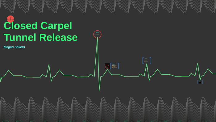 Closed Carpel Tunnel Release by Megan Sellers on Prezi