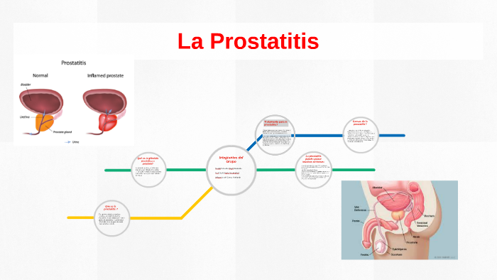 la prostatitis by sowil serna on Prezi