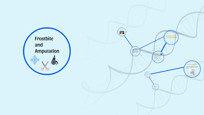 Frostbite and Amputation by viviana jimenez on Prezi