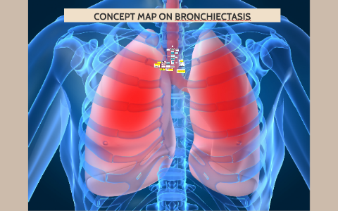 Concept Map on Bronchiectasis by Meder Go on Prezi