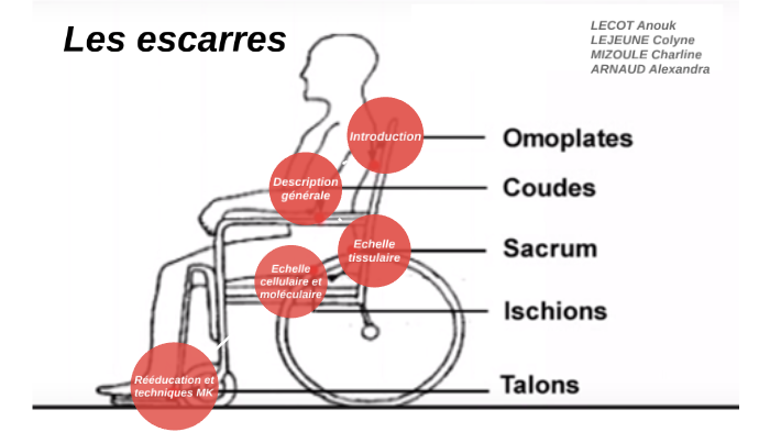 Les escarres by alexandra arnaud on Prezi