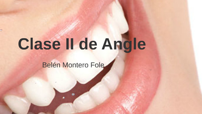 Clase II de Angle by Belén Montero on Prezi