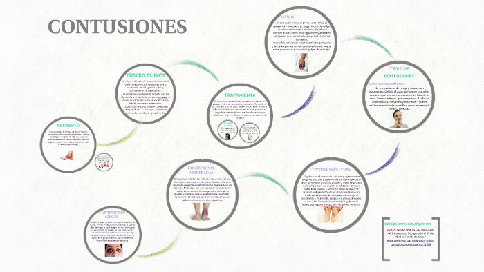 CONTUSIONES by ANA BELEN NICOLA on Prezi