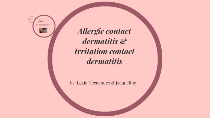 Allergic contact dermatitis & Irritation contact dermatitis by lexie ...