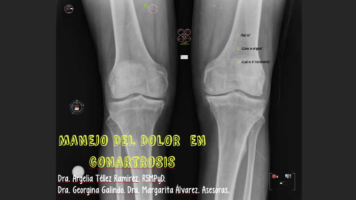 Gonar by Argy TR on Prezi