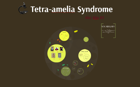 Tetra-amelia Syndrome by Alec Rijo on Prezi