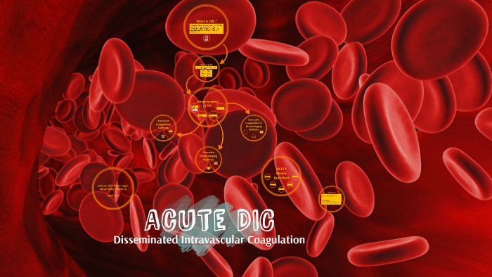 Acute DIC (Disseminated Intravascular Coagulation) by D Sabu on Prezi
