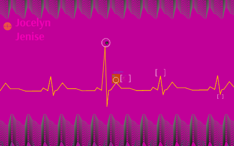 Jocelyn Jenise Robinson by Pecs Griffin on Prezi