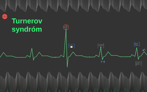Turnerov syndróm by Katarína Komáčková on Prezi