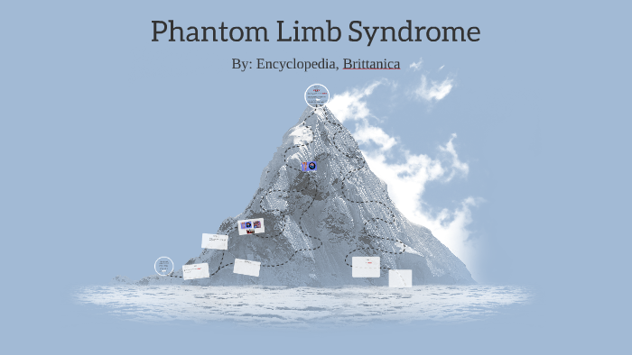Phantom Limb Syndrome by RHS Bears on Prezi