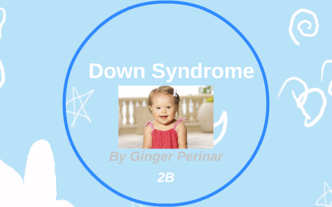 Down Syndrome by Ginger Perinar on Prezi