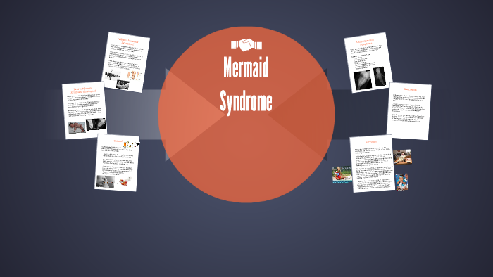Mermaid Syndrome by Adrianna` Schultz on Prezi