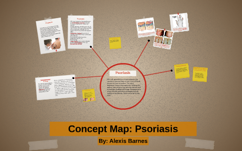 Concept Map: Scabies by SIERAH WHITE on Prezi