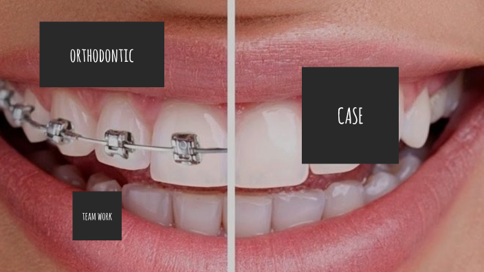 ORTHO CASE PRESENTATION by joud aljuhani on Prezi