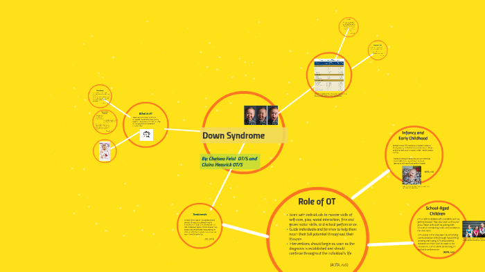 Down Syndrome by Chelsea Feist on Prezi