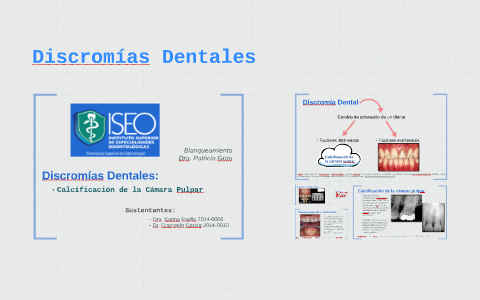 Discromias Dentales by Giancarlo Garcia C. on Prezi