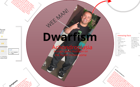 Dwarfism by Nicholas Pointer on Prezi