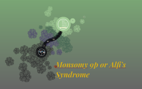 Monsomy 9p or Alfi's Syndrome by Monica Claudio on Prezi