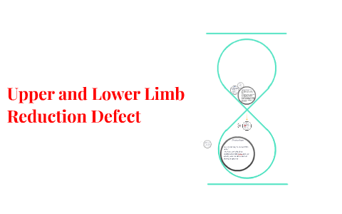 Upper and Lower Limb Reduction Defect by Colbi Schertz on Prezi