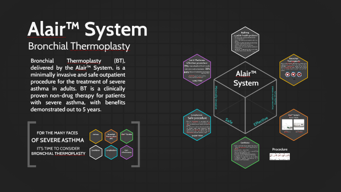 Alair System by Marco Pinto on Prezi