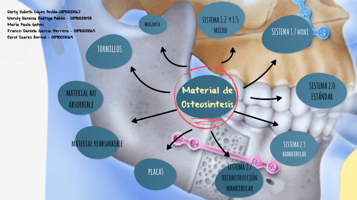 Material de osteosintesis maxilofacial by Darly Yulieth Lopez Ardila on ...