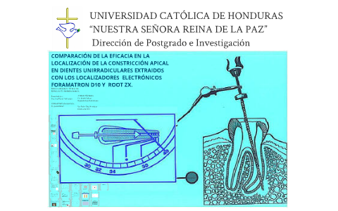 TESIS - COMPARACION DE LA EFICACIA EN LA LOCALIZACION DE LA ...