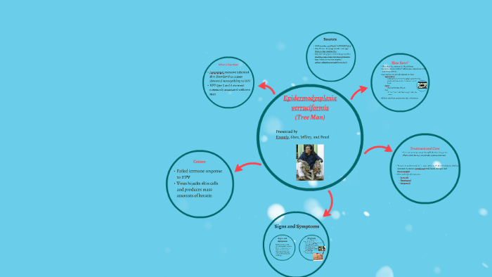 Epidermodysplasia verruciformis (Tree Man) by Kristen Kirk on Prezi
